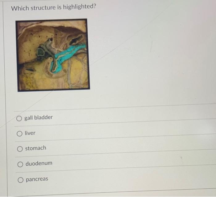 Solved Which structure is highlighted? gall bladder liver | Chegg.com