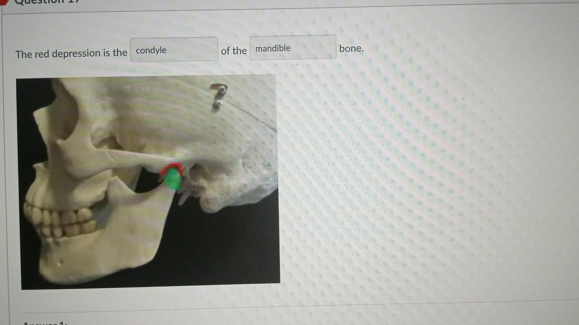 Solved The red depression is the of the bone. | Chegg.com