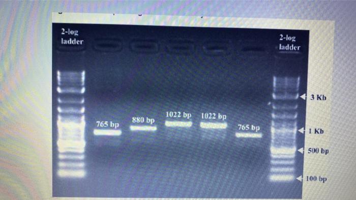 Solved 2-log ladder 2-log ladder 3 Kb 1022 bp 1022 bp 765 bp | Chegg.com