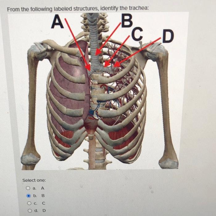 Solved From the following labeled structures, identify the | Chegg.com