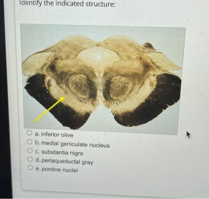 Solved Identify the indicated structure: a. inferior olive O | Chegg.com