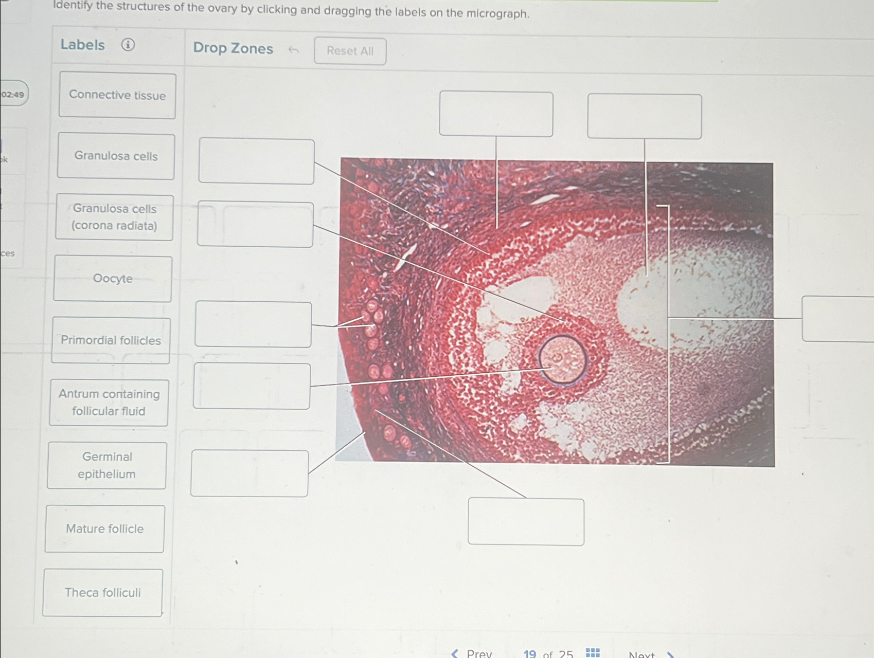 Solved Identify the structures of the ovary by clicking and | Chegg.com