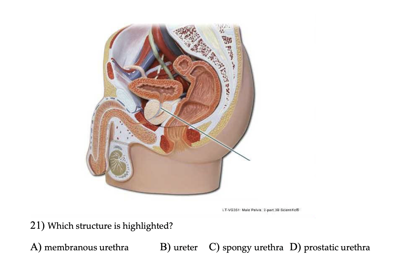 Solved LT-vg351- Male Pelvis 2-part, 38 Scientifine21) | Chegg.com Solved LT-vg351- Male Pelvis 2-part, 38 Scientifine21) | Chegg.com