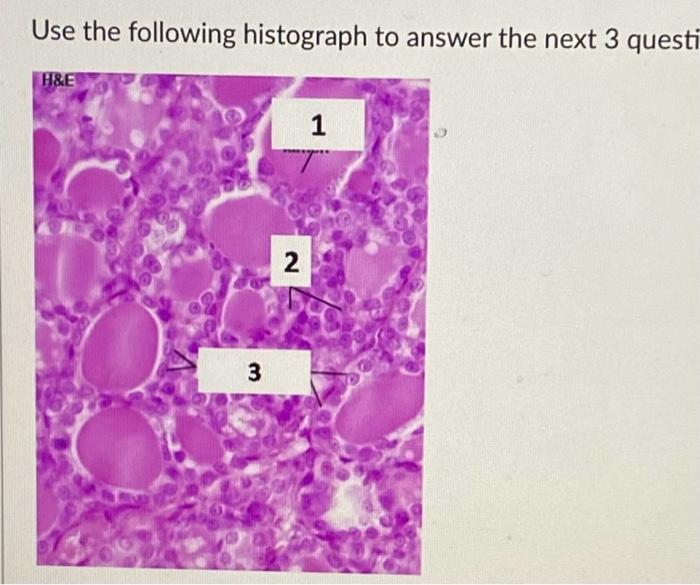 Solved Use the following histograph to answer the next 3 | Chegg.com