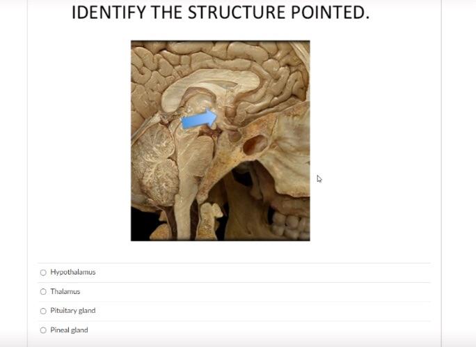 Solved IDENTIFY THE STRUCTURE POINTED. Hypothalamus Thalamus | Chegg.com