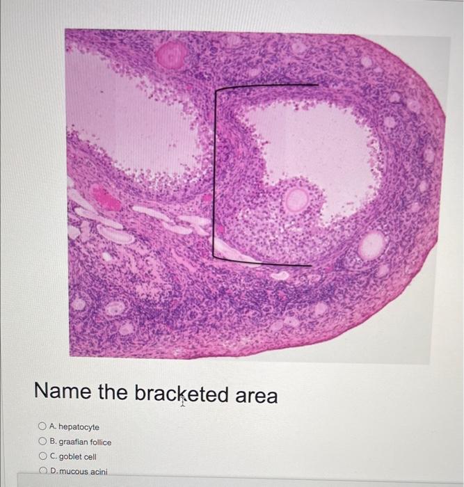 Solved Name the bracketed area A. hepatocyte B. graafian | Chegg.com