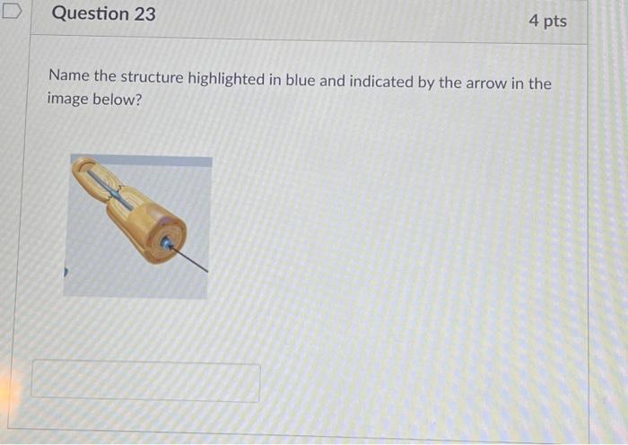 Name the structure highlighted in blue and indicated | Chegg.com