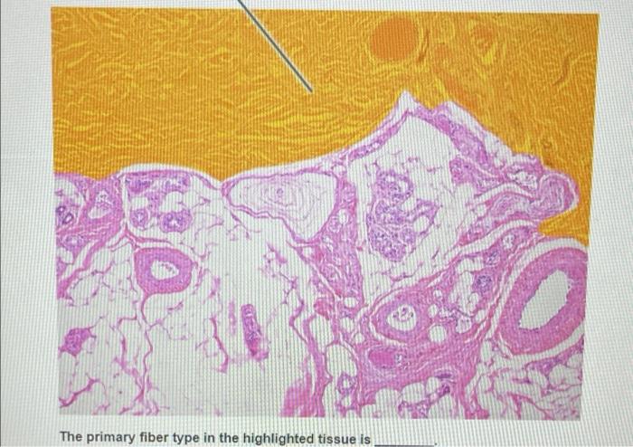 Solved The primary fiber type in the highlighted tissue is | Chegg.com