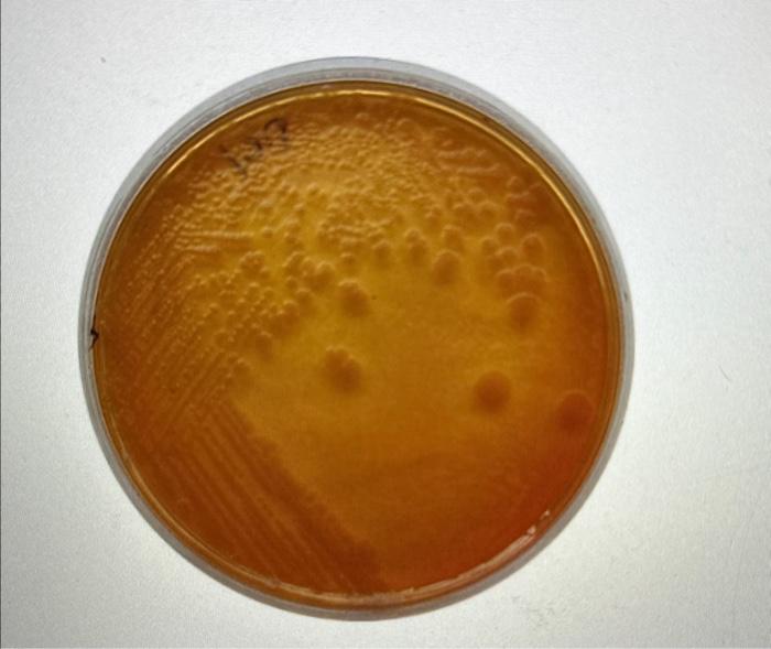 Solved this is SS agar, describe the results | Chegg.com