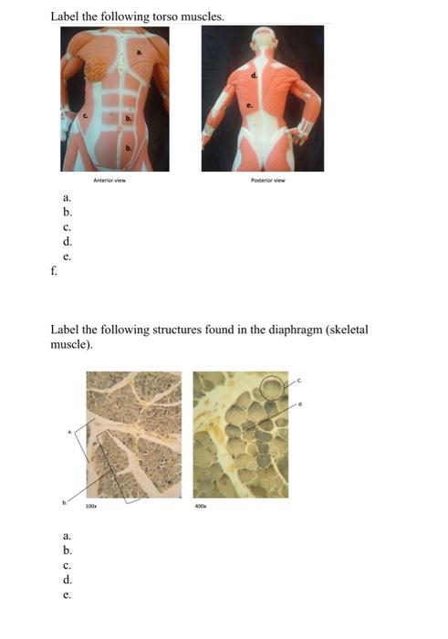 Solved Label the following torso muscles. Anterior view a. | Chegg.com