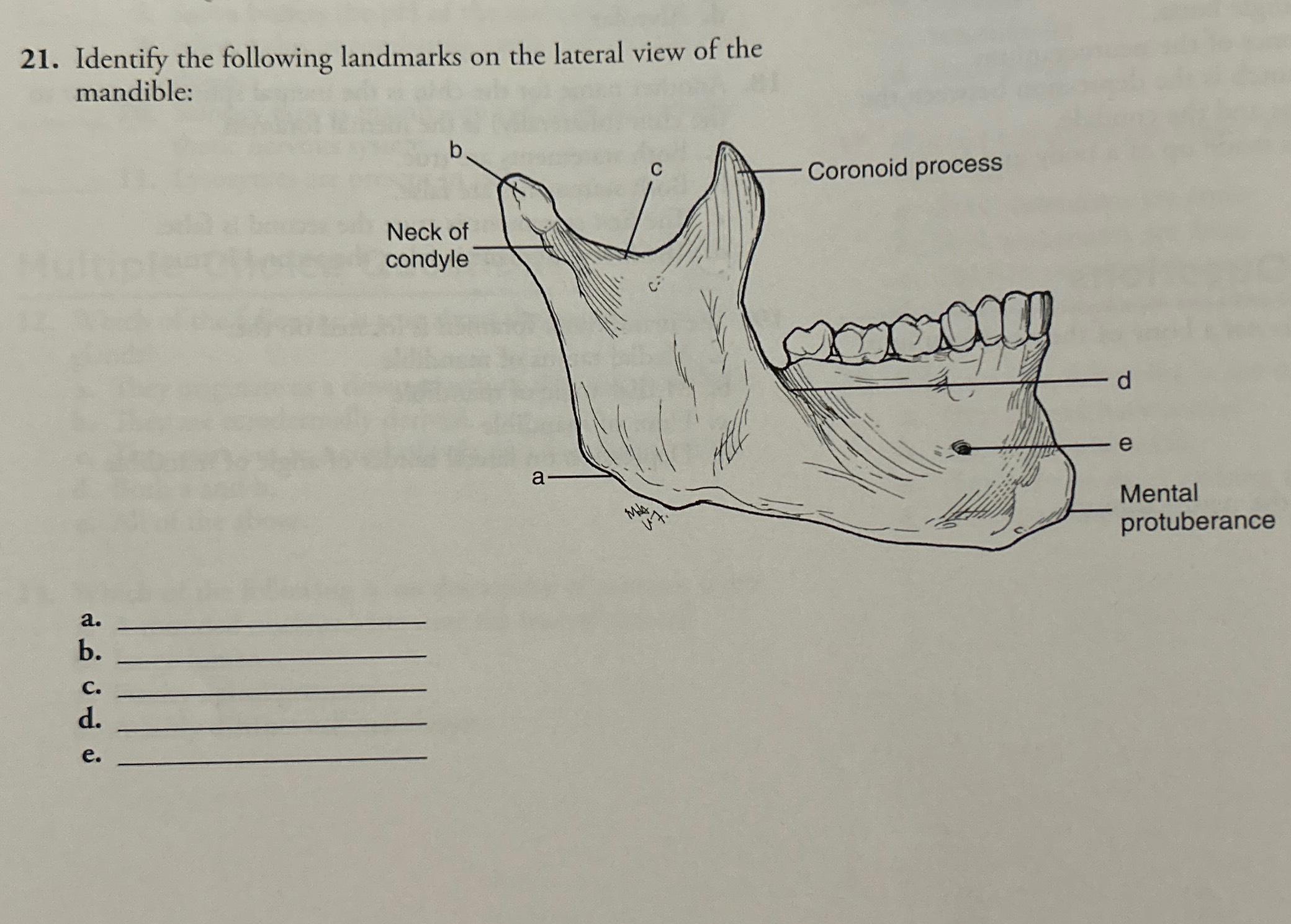 Solved Identify the following landmarks on the lateral view | Chegg.com