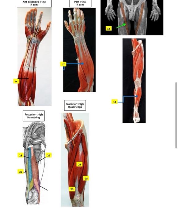 Solved 22 Ant extended view Rarm Posterior thigh Hamstring | Chegg.com