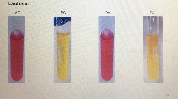 Solved Citrate utilization, MR, and VP results citrate color | Chegg.com