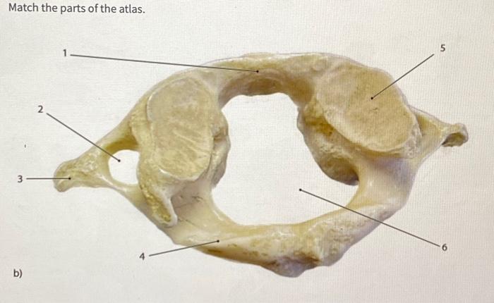 Solved Match the parts of the atlas. | Chegg.com