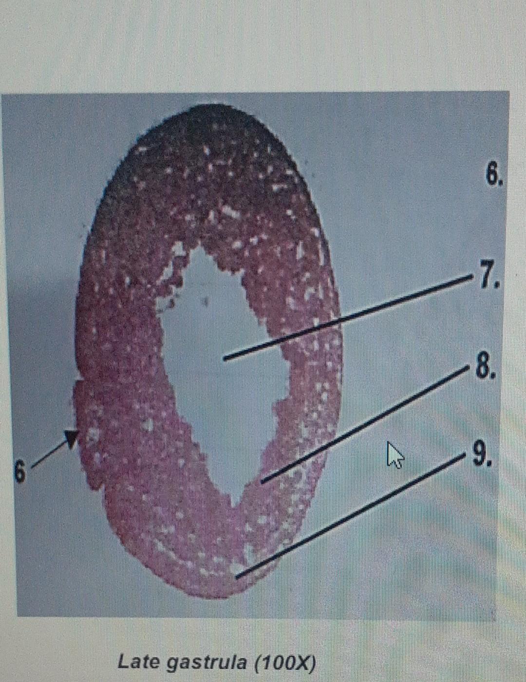 Solved 6. 7. 8. 9 . Late gastrula (100X) | Chegg.com