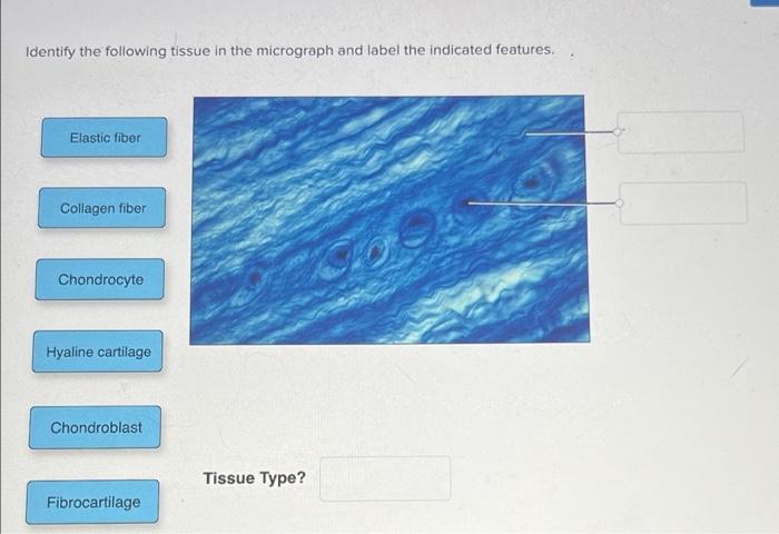 Identify the following tissue in the micrograph and | Chegg.com Identify the following tissue in the micrograph and | Chegg.com