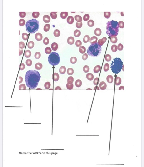Solved answer the figer below with purpole colors for WBC | Chegg.com