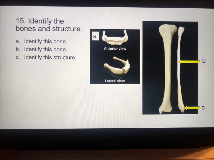 Solved 15. Identify the bones and structure. a a. Identify | Chegg.com