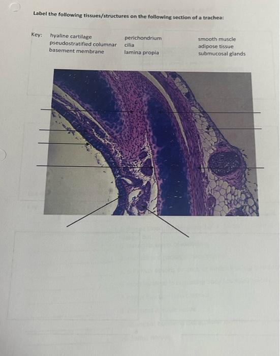 Solved Label the following tissues/structures on the | Chegg.com Solved Label the following tissues/structures on the | Chegg.com