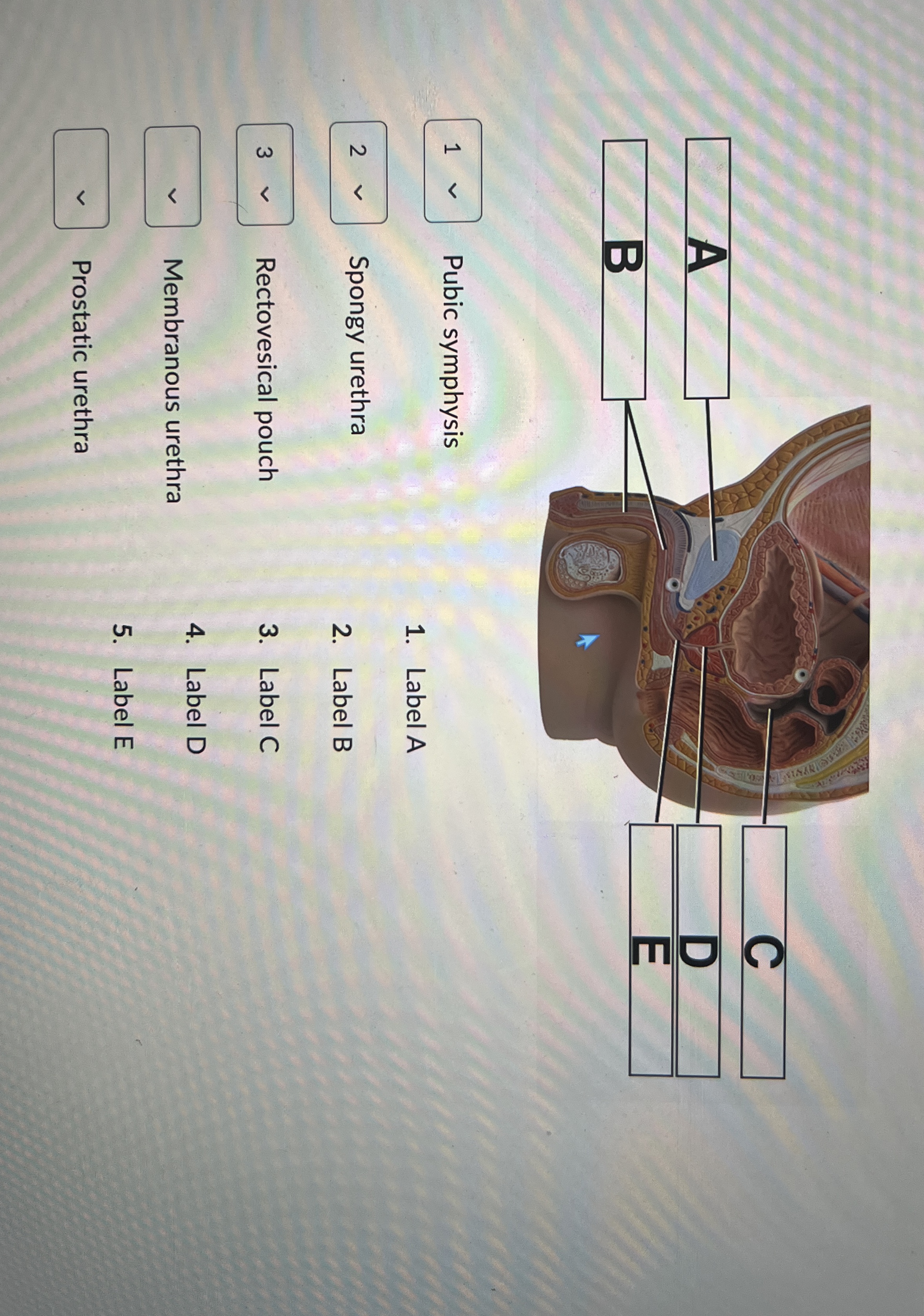Pubic symphysis ﻿Spongy urethra ﻿Rectovesical | Chegg.com
