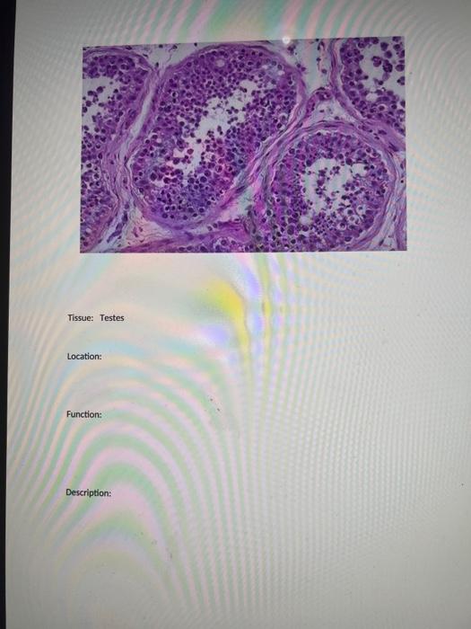 Solved Tissue: Testes Location: Function: Description: | Chegg.com