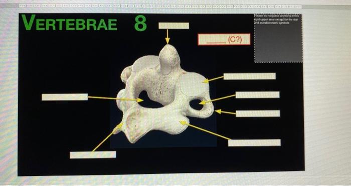 Solved Name the parts of the vertebrae using numbers or | Chegg.com