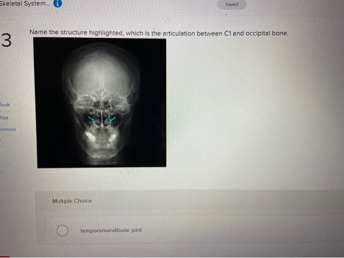 Solved Skeletal System... Saved Name the structure | Chegg.com
