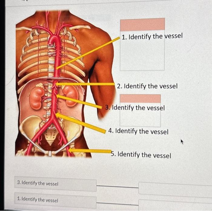 Solved 3. Identify the vessel 1. Identify the vessel 1. | Chegg.com
