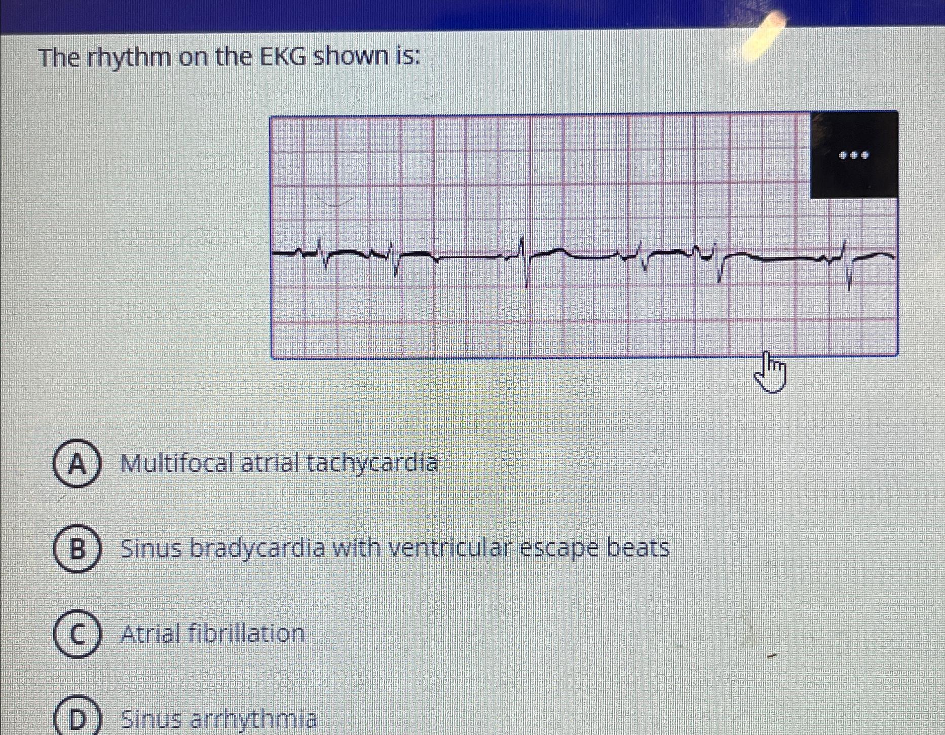 Solved The rhythm on the EKG shown is:Multifocal atrial | Chegg.com
