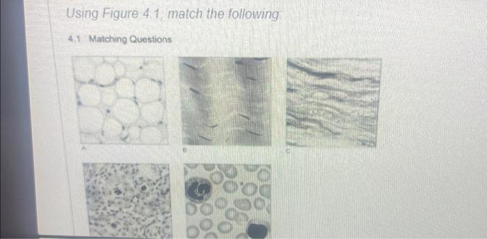 Using Figure 4.1 , match the following | Chegg.com