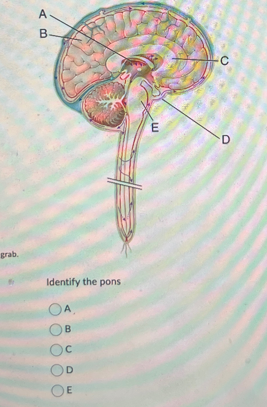 Solved Identify the ponsABCDE | Chegg.com