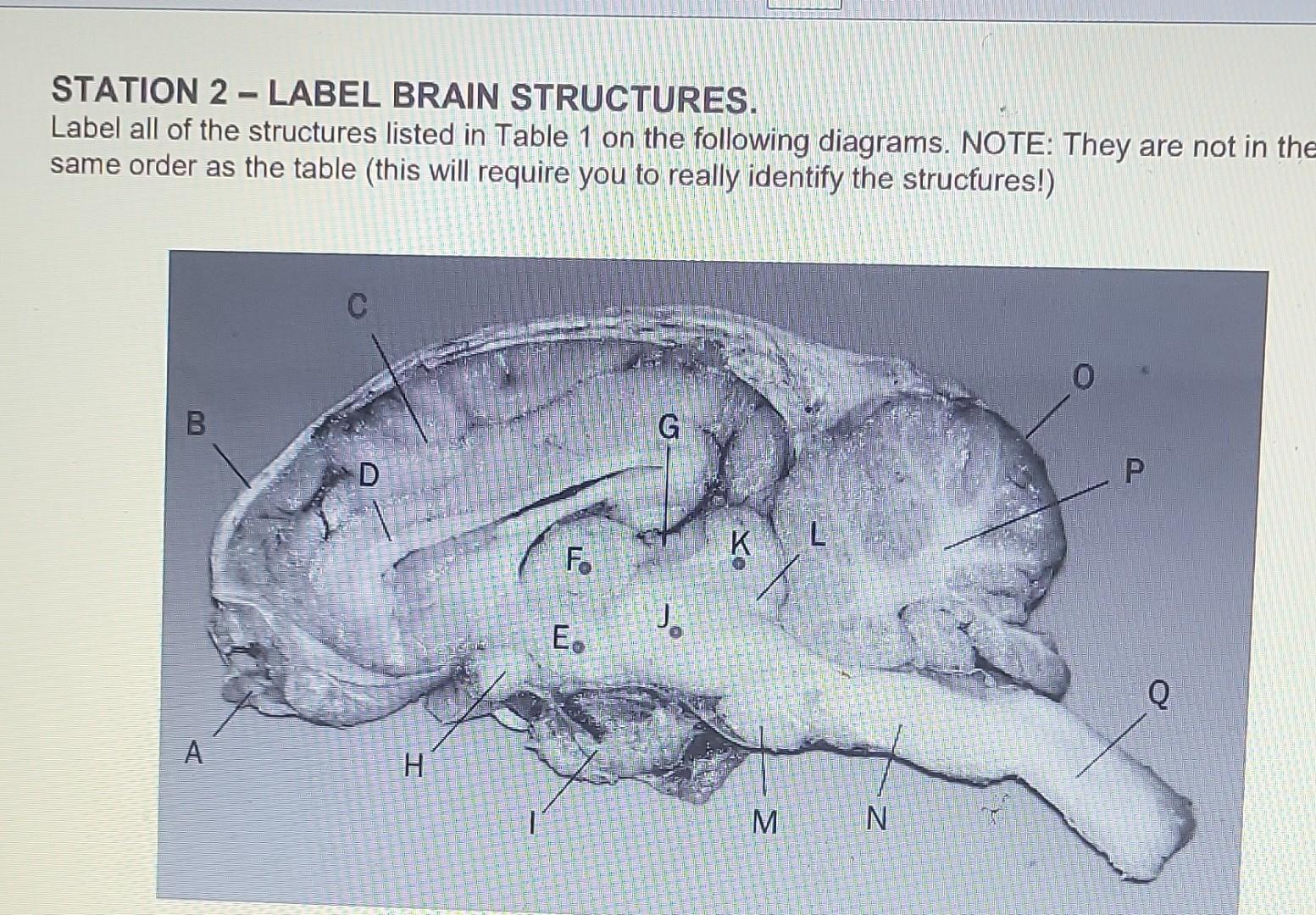 Solved STATION 2 - LABEL BRAIN STRUCTURES. Label all of | Chegg.com