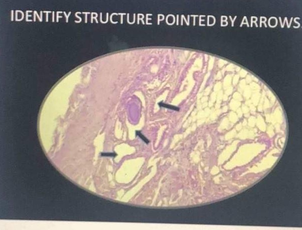 Solved IDENTIFY STRUCTURE POINTED BY ARROWS | Chegg.com