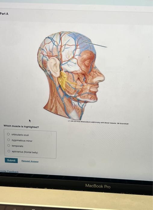 Solved Which muscle is highlighted? orbicularis oculi | Chegg.com