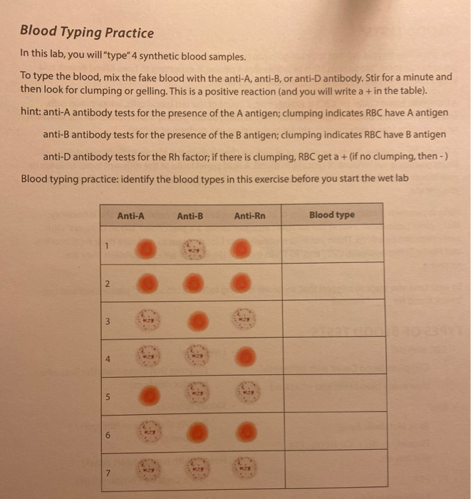 Solved Blood Typing Practice In this lab, you will "type" 4 | Chegg.com