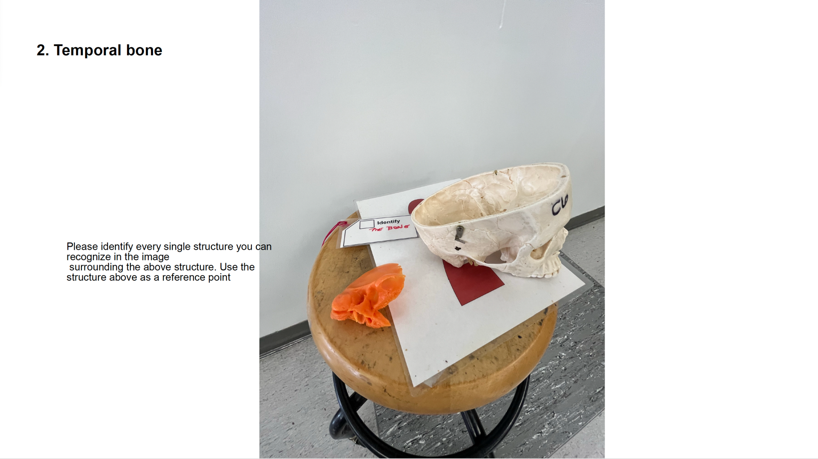 Solved Temporal bonePlease identify every single structure | Chegg.com