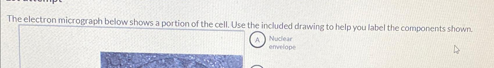 Solved The electron micrograph below shows a portion of the | Chegg.com