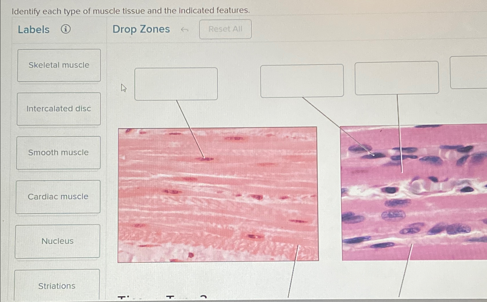Solved Identify each type of muscle tissue and the indicated | Chegg.com