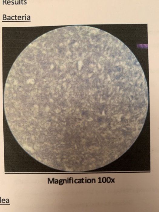 need help making a scale bar magnification: | Chegg.com
