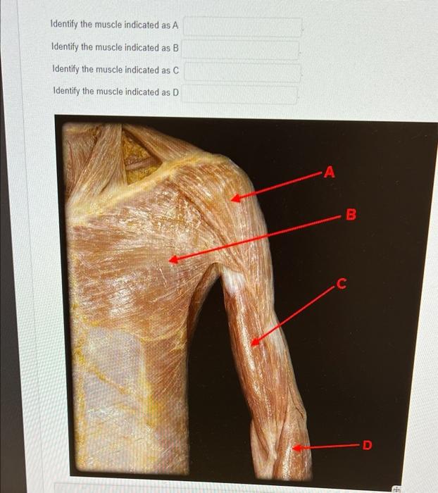 Solved Identify the muscle indicated as A Identify the | Chegg.com