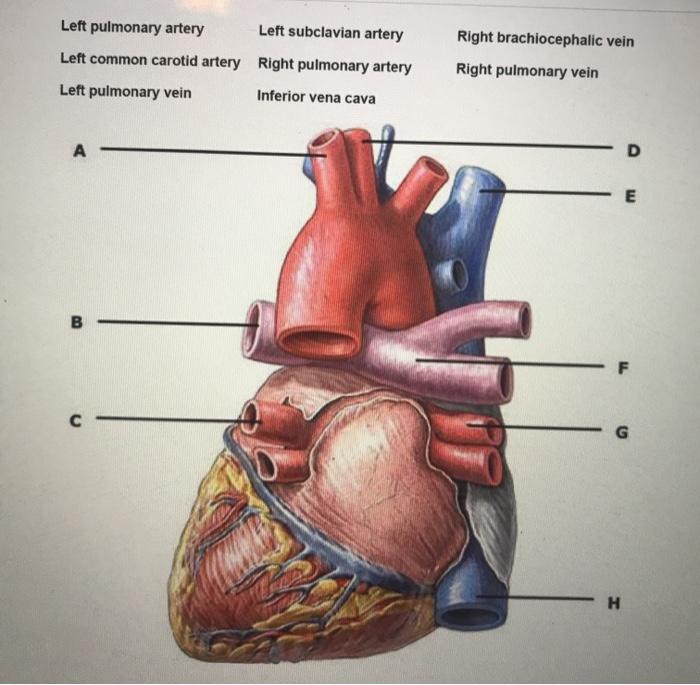Solved Left common carotid artery Brachiocephalic trunk Left | Chegg.com