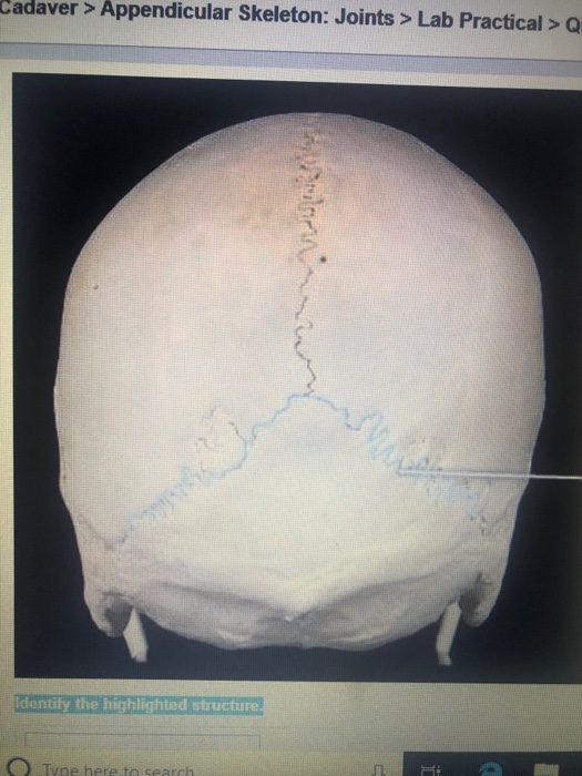 Solved Cadaver > Appendicular Skeleton: Joints > Lab | Chegg.com Solved Cadaver > Appendicular Skeleton: Joints > Lab | Chegg.com
