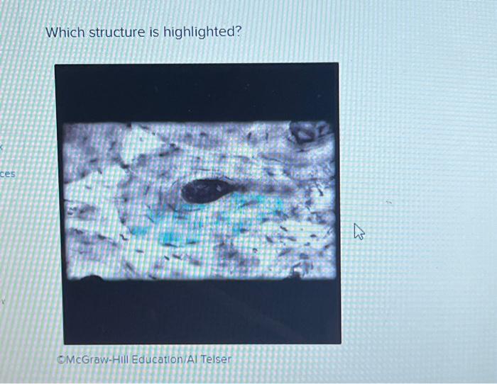 Solved Which structure is highlighted?Name the structure | Chegg.com Solved Which structure is highlighted?Name the structure | Chegg.com