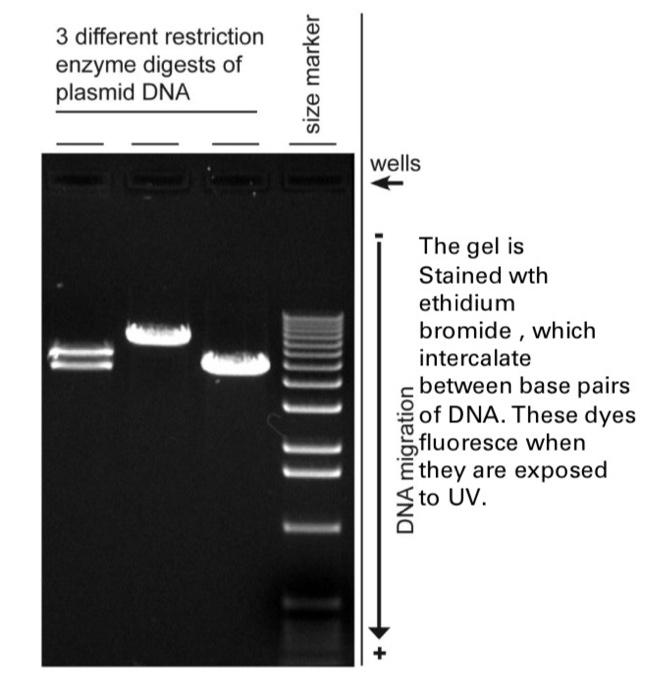 Solved 3 different restriction enzyme digests of plasmid DNA | Chegg.com