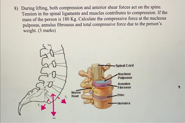 Solved 3) During lifting, both compression and anterior | Chegg.com