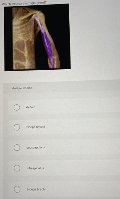 Solved Which structure is highlighted? Multiple Choice O | Chegg.com