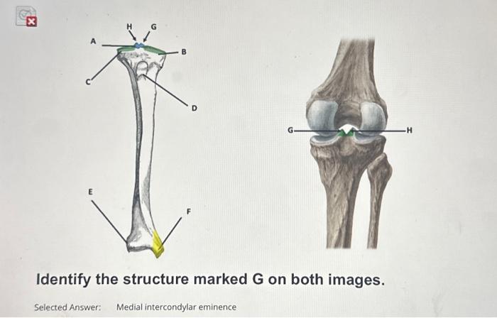 Solved Identify the surface highlighted in green and | Chegg.com