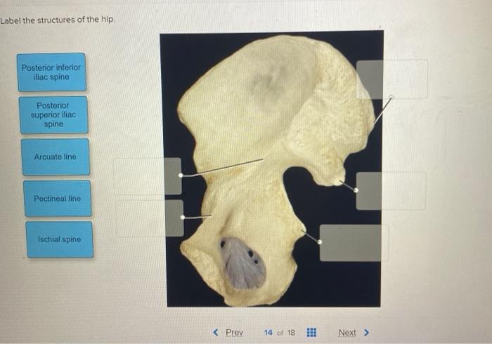 Solved Label the structures of the hip. Posterior inferior | Chegg.com Solved Label the structures of the hip. Posterior inferior | Chegg.com
