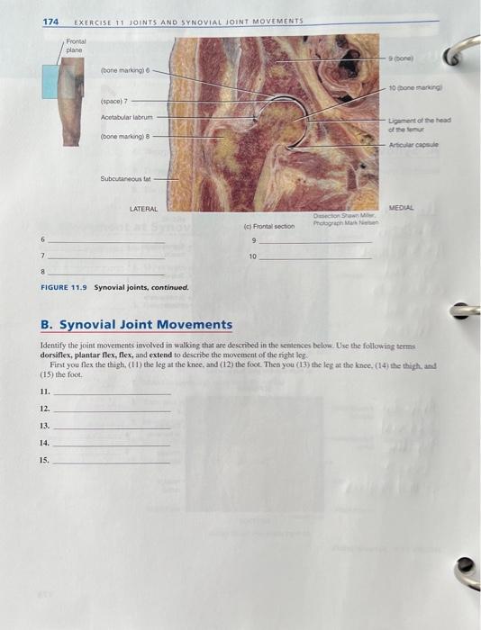 Identify the synovial joint structures of the | Chegg.com
