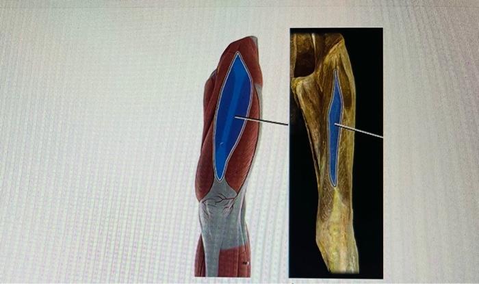 Solved whats highlighted region called? | Chegg.com